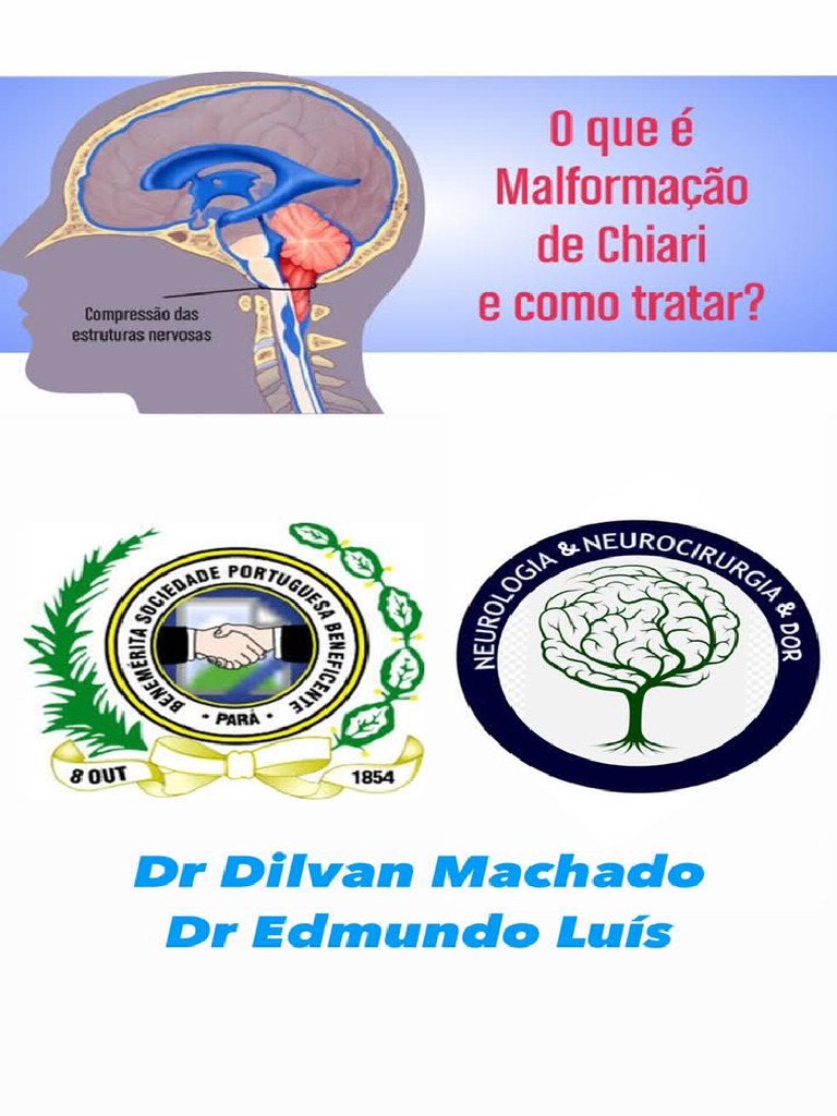 Mal Formação Chiari DR DILVAN | PDF