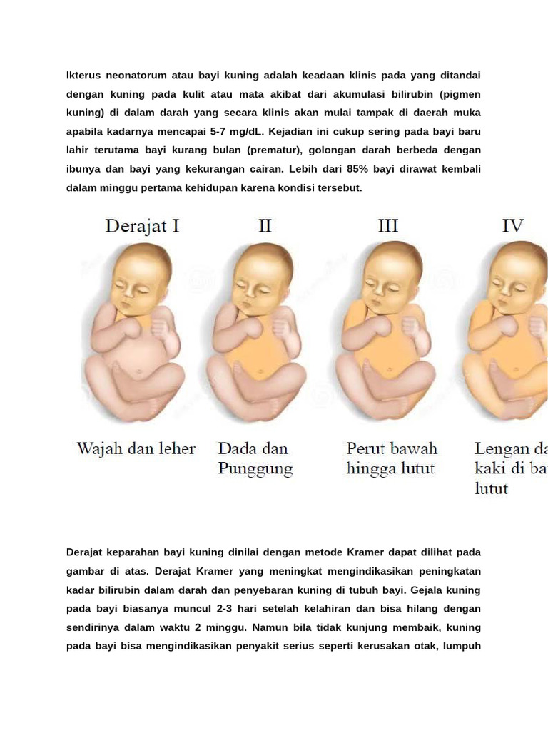 Klasifikasi dan Derajat Ikterus Neonatorum | PDF