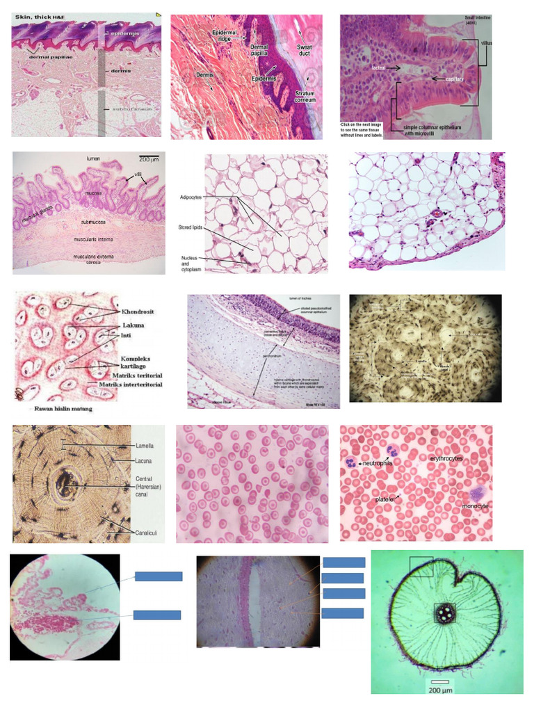 Preparat Laprak | PDF