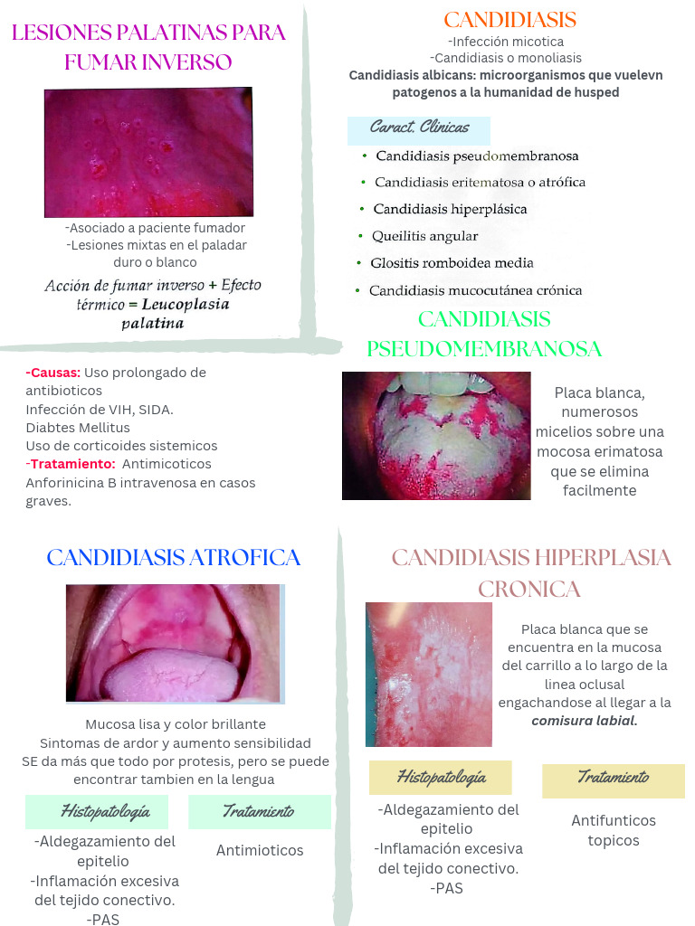 Tipos de Candidiasis Oral y Tratamientos | PDF | Candidiasis | Medicina