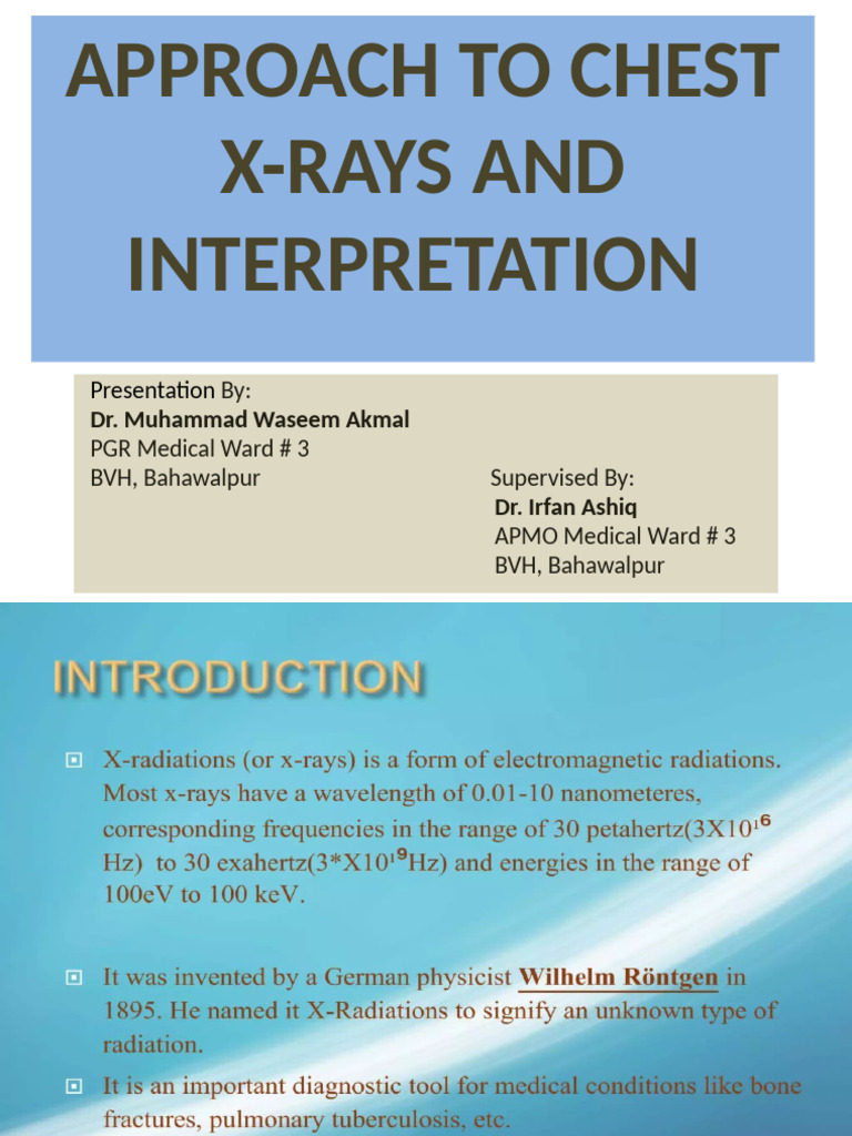 Approach To Chest X-Rays and Interpretation by Dr. Muhammad Waseem ...