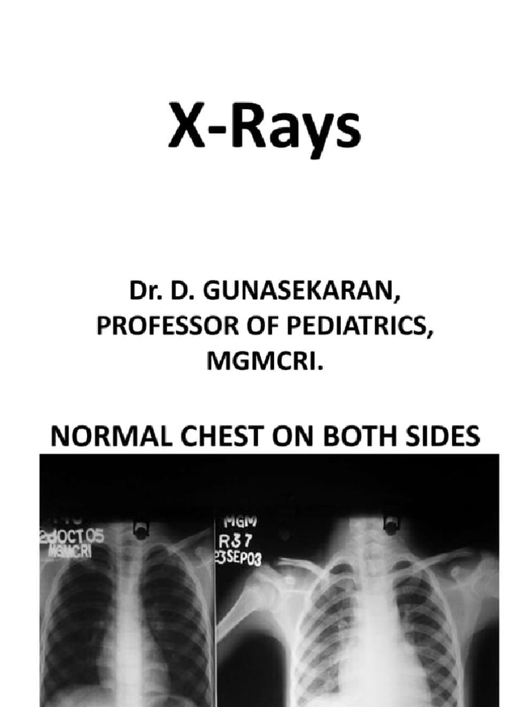 X Rays Ug Students DR D Gunasekaran Professor of Pediatrics 59759466 | PDF