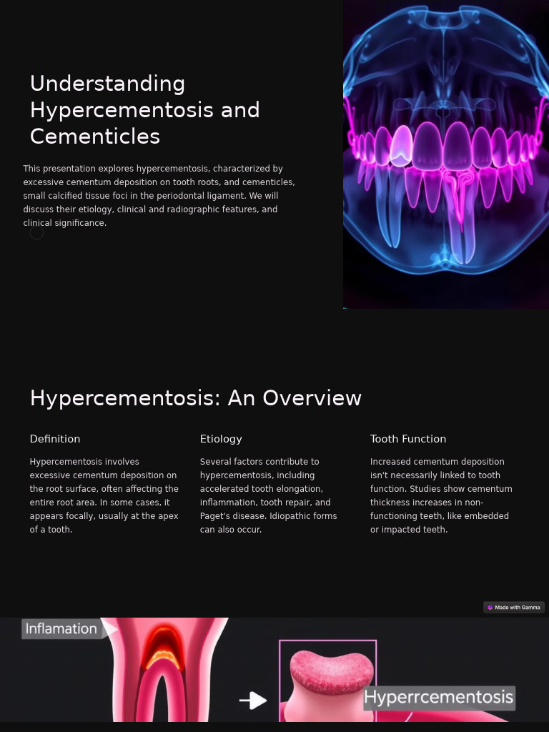 Understanding Hypercementosis and Cementicles | PDF | Human Tooth | Anatomy