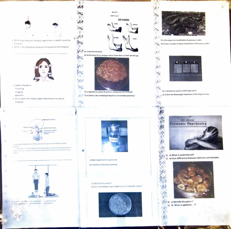 Forensic Analysis of Hanging and Strangulation | PDF | Forensic Science ...