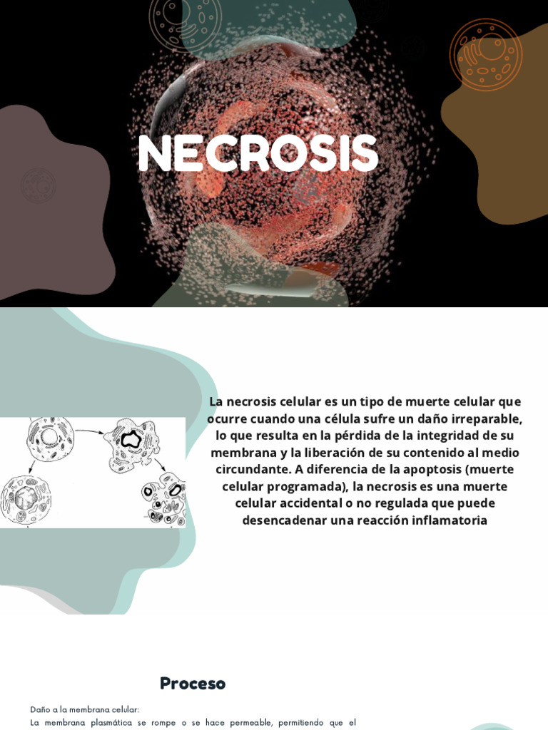 Necrosis | PDF | Inflamación | Biología Celular)