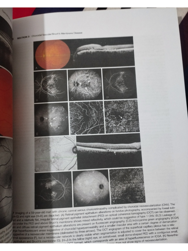 Image To PDF 20250602 23.03.41 | PDF