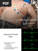 15 Lead ECG Placement Guide | PDF