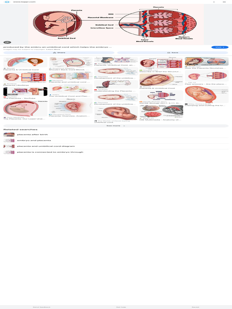How Is Placenta Connected To Embryo and Mother - Google Search | PDF ...
