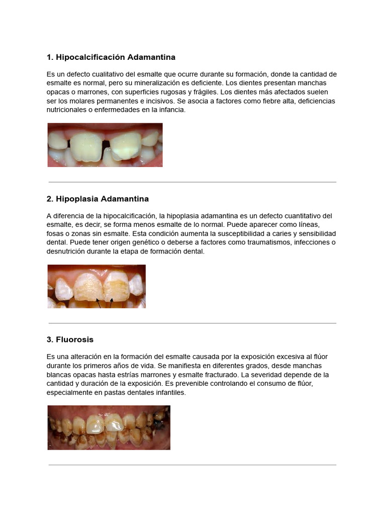 Defectos del Esmalte Dental: Tipos y Causas | PDF | Enfermedades y ...