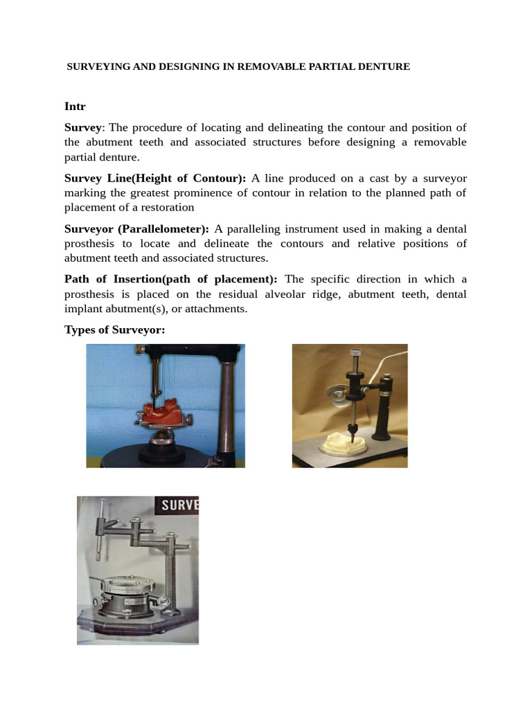 Surveying in Removable Partial Denture | PDF | Dentures | Dentistry ...