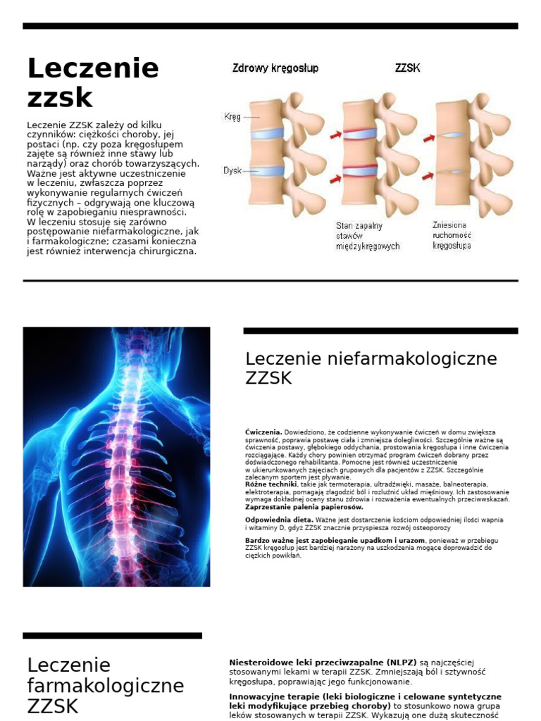 Leczenie ZZSK | PDF