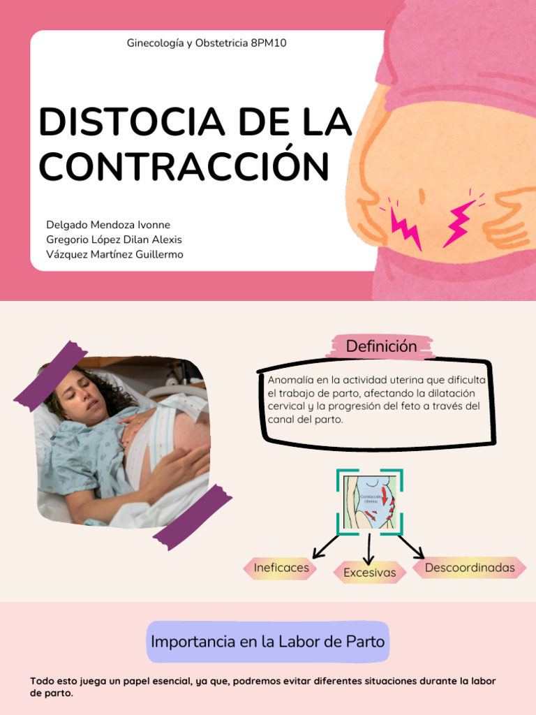 Distocia de Contracción Uterina | PDF | Parto | Obstetricia