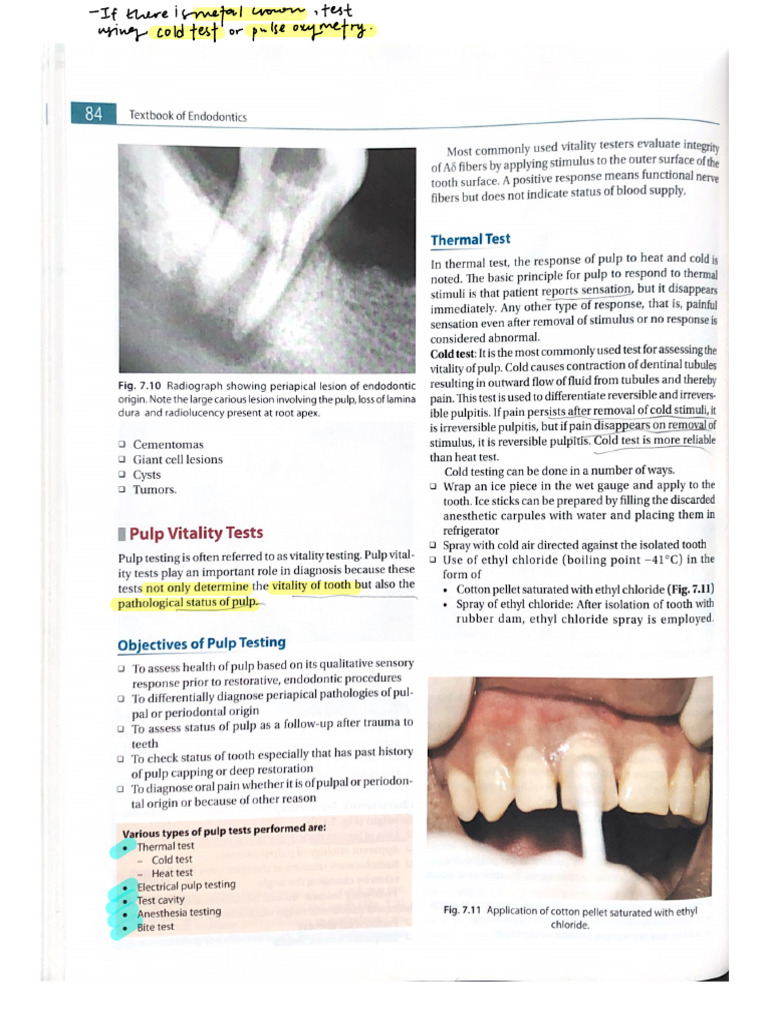 Pulp Vitality Test | PDF