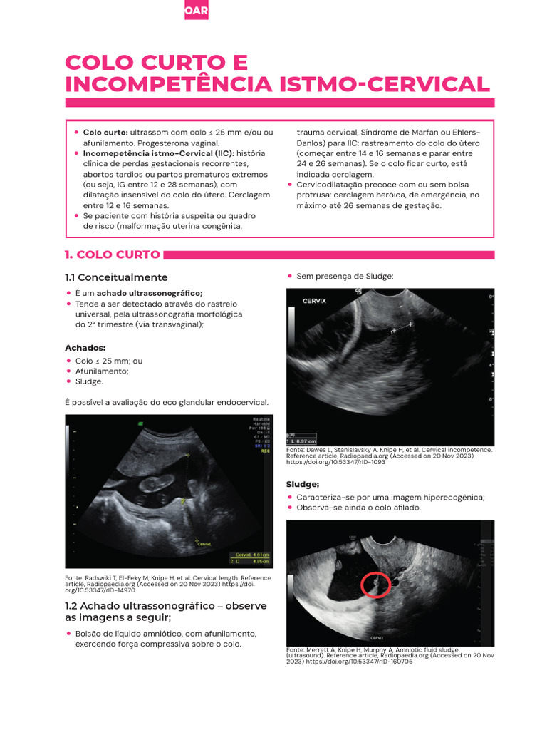 16 - Colo Curto e Insuficiência Ístmo-Cervical | PDF | Reprodução ...
