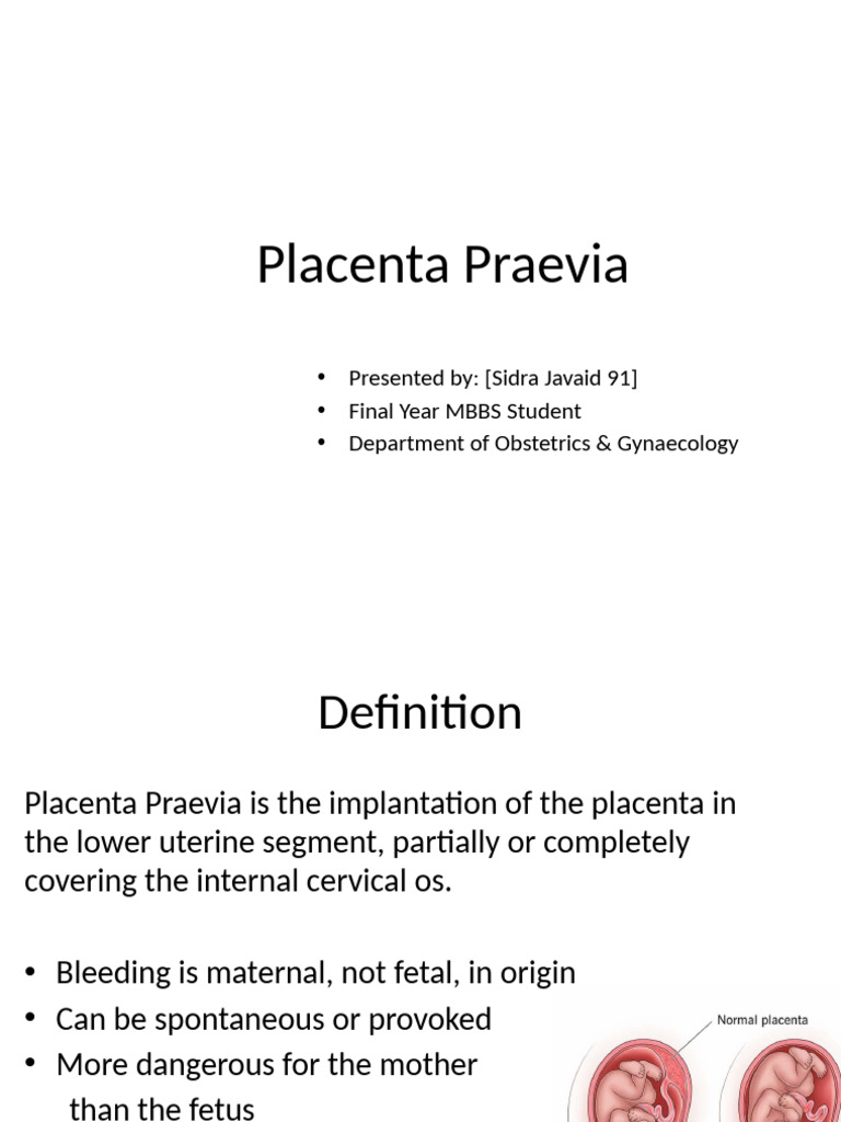 Placenta Previa Presentation1 | PDF | Human Reproduction | Motherhood