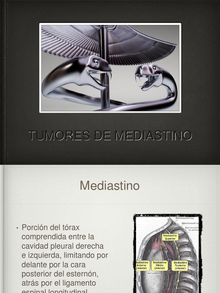 Tumores de Mediastino | PDF | Linfoma | Cáncer