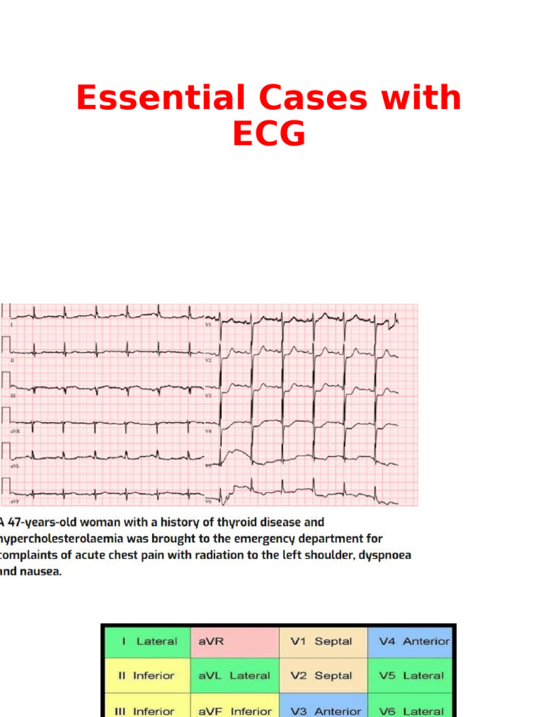 Essential Cases With ECG | PDF