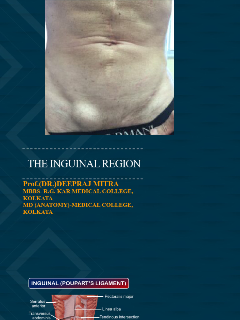 The Inguinal Region - Final | PDF | Musculoskeletal System | Soft Tissue