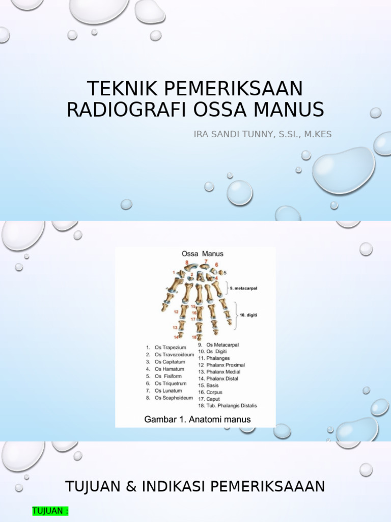 Pemeriksaan Radiografi Ossa Manus | PDF