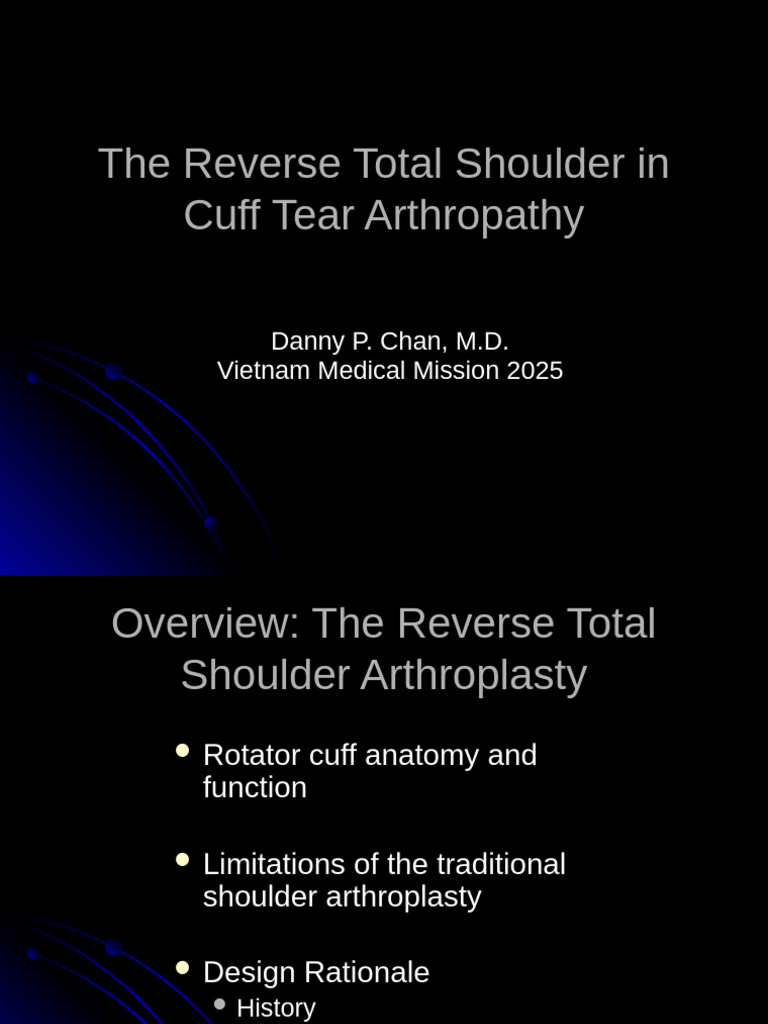 Danny P. Chan-Reverse Total Shoulder Presentation 2025-04-04 | PDF ...