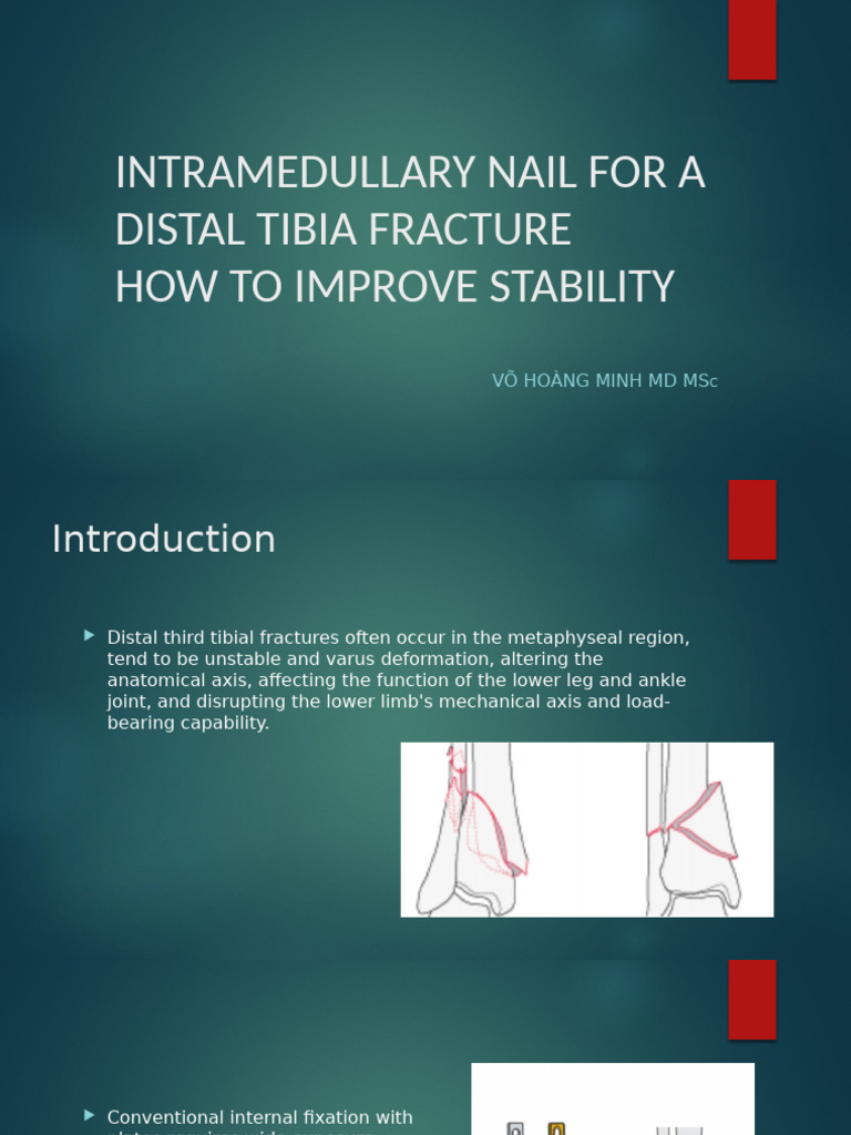 VO HOANG MINH MD - Intramedullary Nail For A Distal Tibia Fracture ...