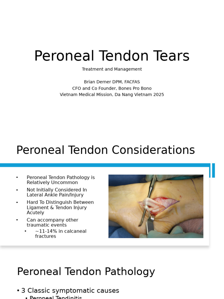 Brian Derner - Peroneal Tendon Tears - Vietnam 2025 | PDF | Ankle | Foot