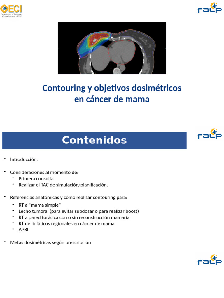 Contouring Radiotherapy Ca Mama | PDF | Pecho | Tórax