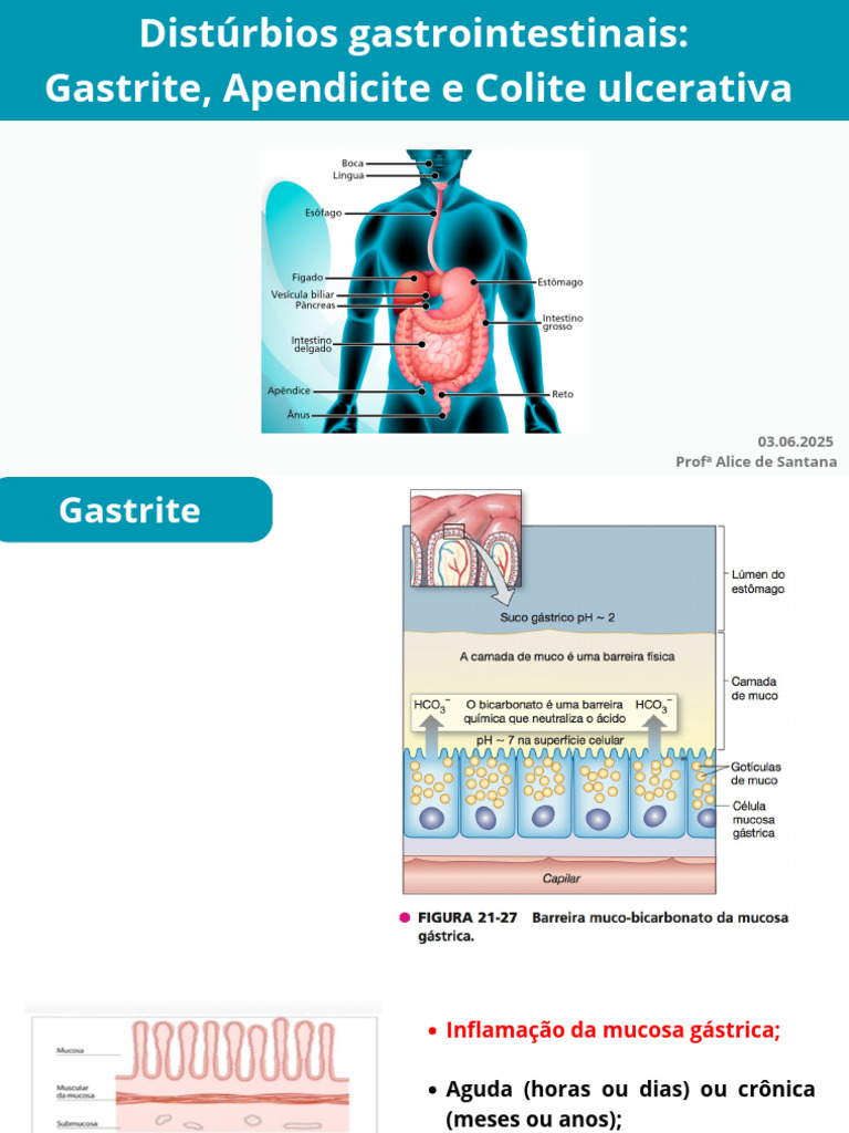 Distúrbios Gastrointestinais: Gastrite e Apendicite | PDF | Doenças e ...
