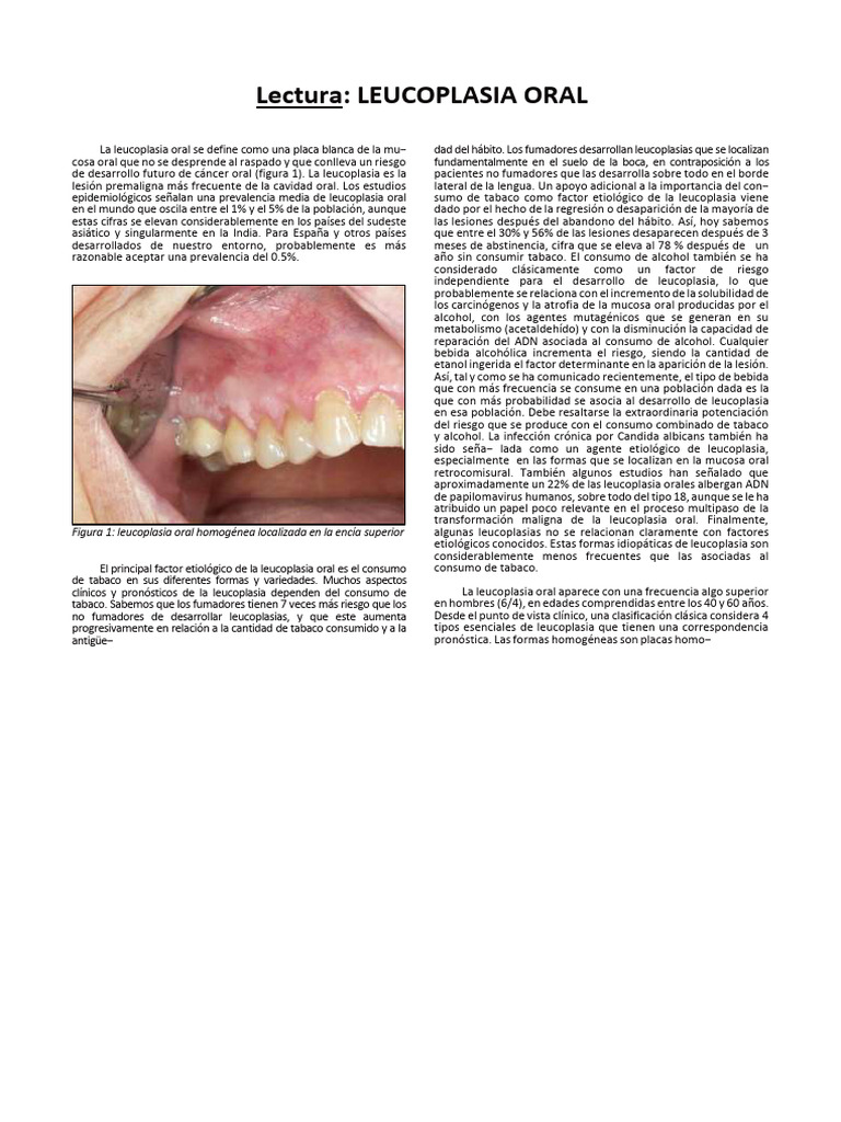 Leucoplasia Oral: Riesgos y Tratamiento | PDF | Cáncer | Enfermedades y ...