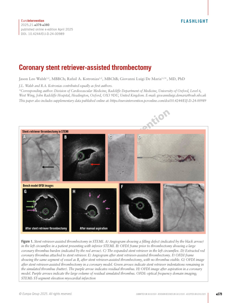 062 - EIJ D 24 00989 - Walsh | PDF | Myocardial Infarction | Angiography