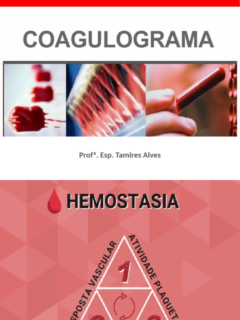 Aula de Coagulograma de Enfermagem, Área Da Saúde | PDF | Hemostasia ...