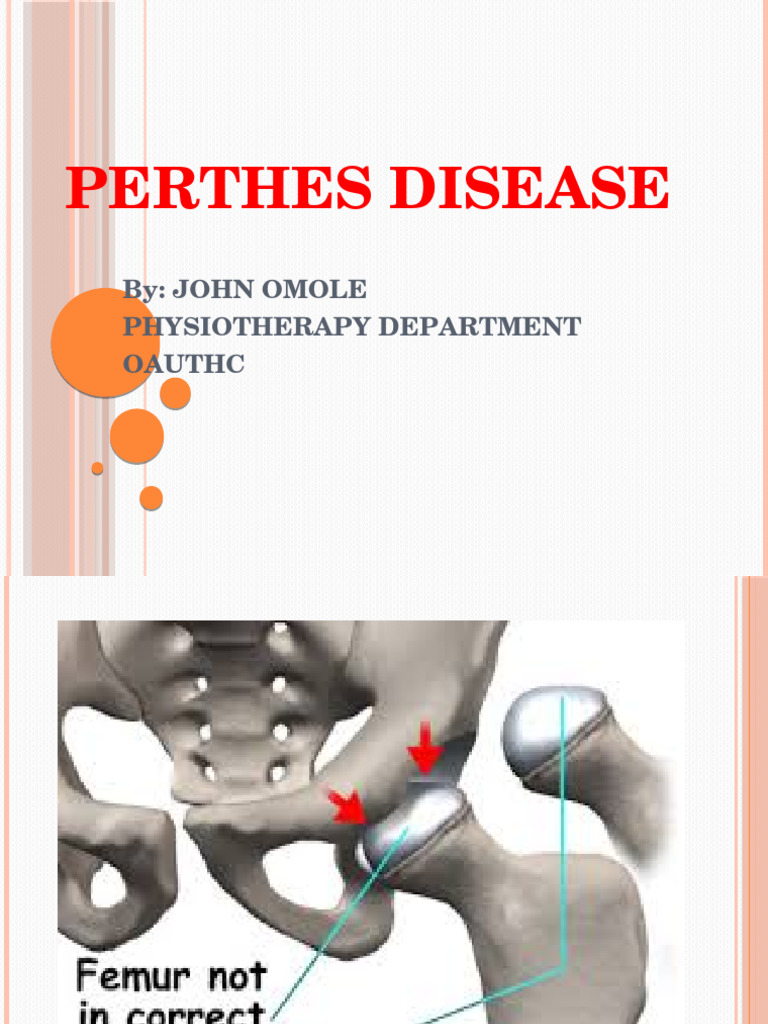 Perthes Disease Lecture Notes | PDF | Diseases And Disorders ...