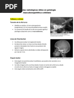 Ángulo Cérvico-Diafisario del Fémur | PDF