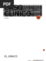 Persistencia de Uraco Resuelto Con Tratamiento Quirúrgico Reporte de ...