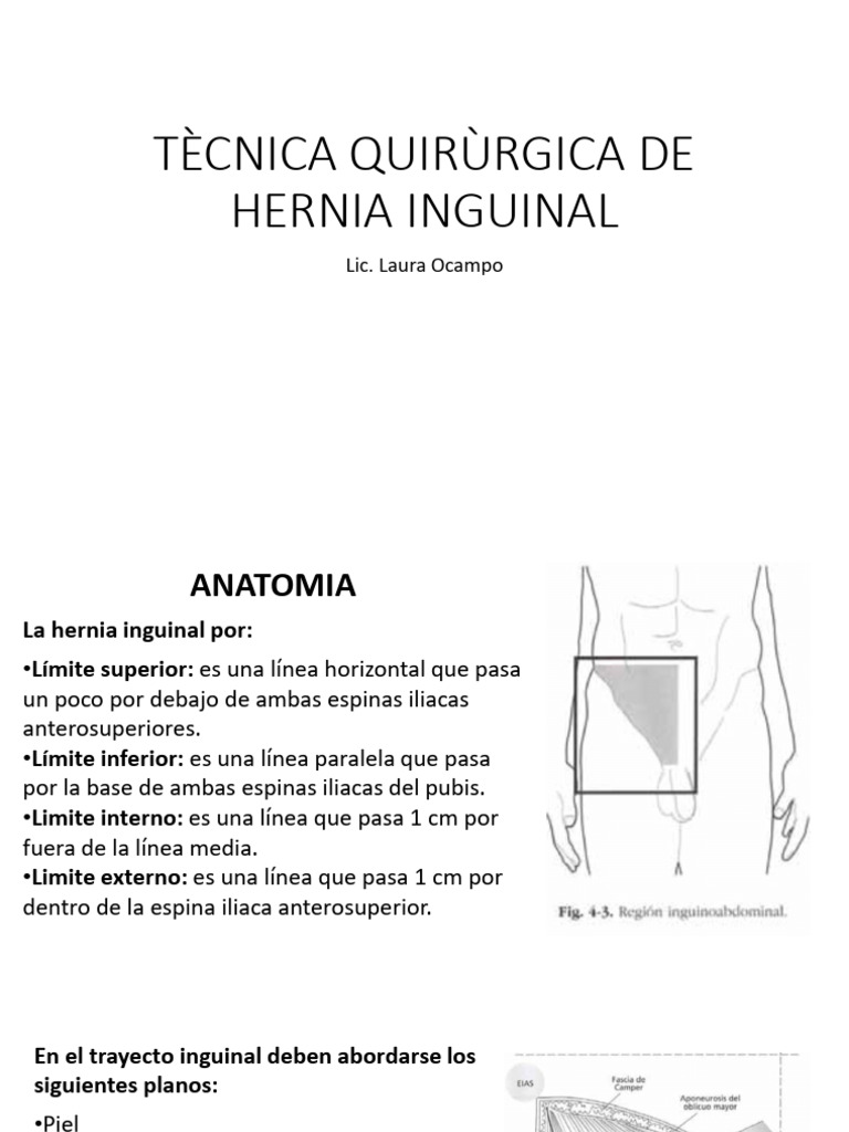 Tecnica Quirurgica de Hernia Inguinal | PDF | Abdomen