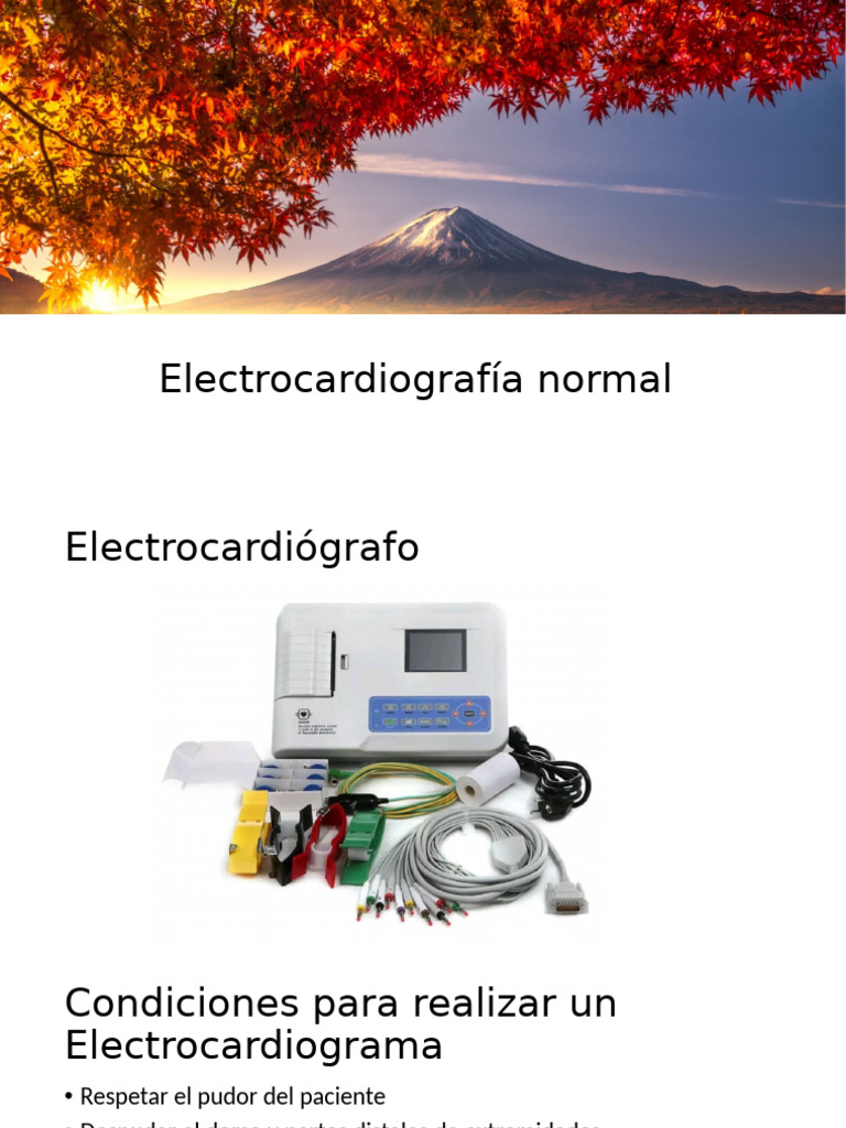 Interpretaciòn Electrocardiografía | PDF