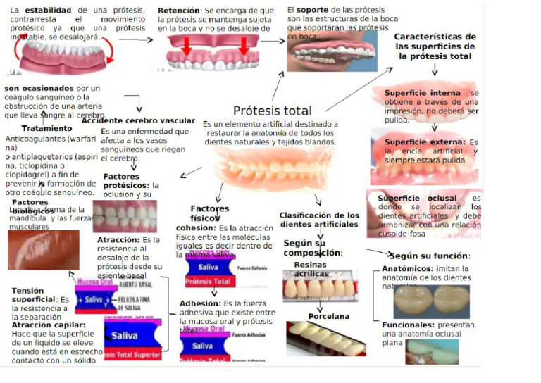 Protesis Total | PDF