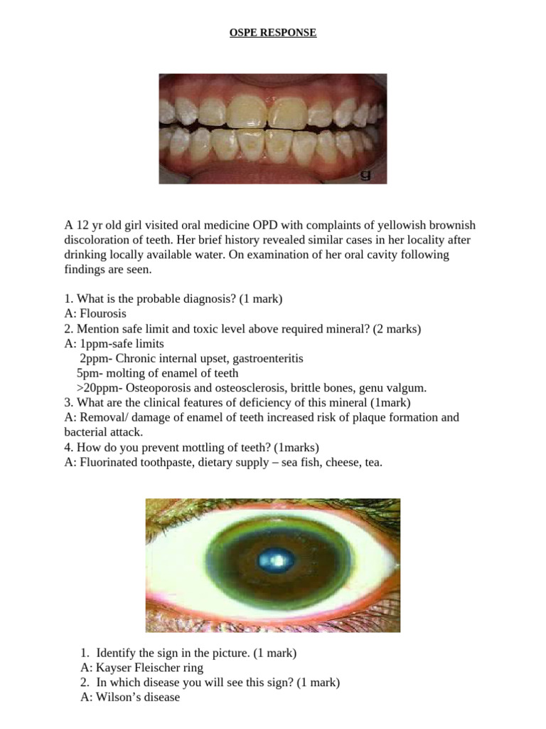 Ospe Response With Answers | PDF