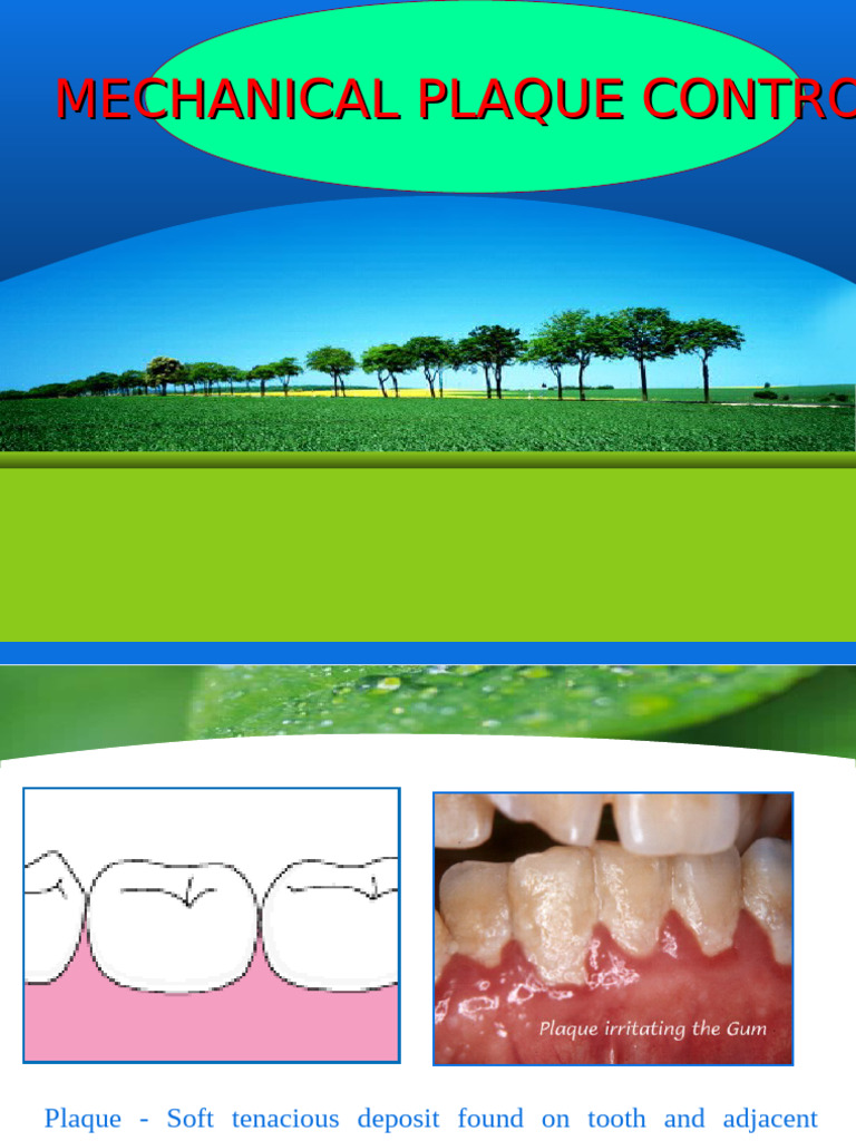 Mechanical Plaque Control Techniques | PDF | Toothbrush | Oral Hygiene