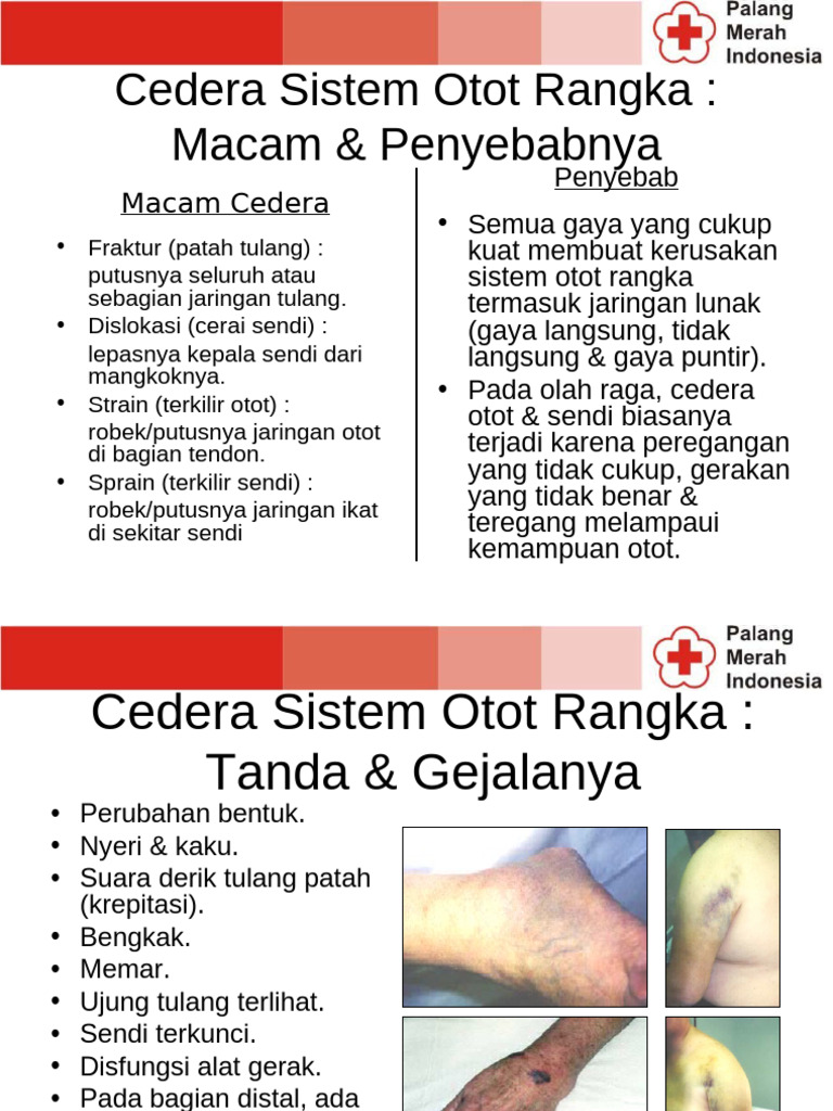 05 CIDERA SISTEM OTOT RANGKA | PDF