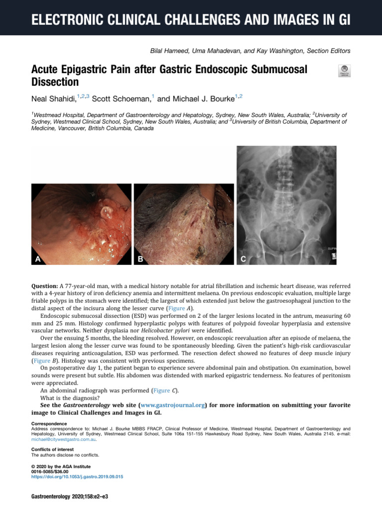 Acute Epigastric Pain After Gastric Endoscopic Sub | PDF | Gastroenterology | Digestive Diseases