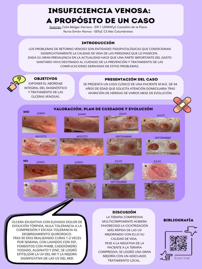 (Póster) Insuficiencia Venosa A Propósito de Un Caso | PDF | Terapia ...