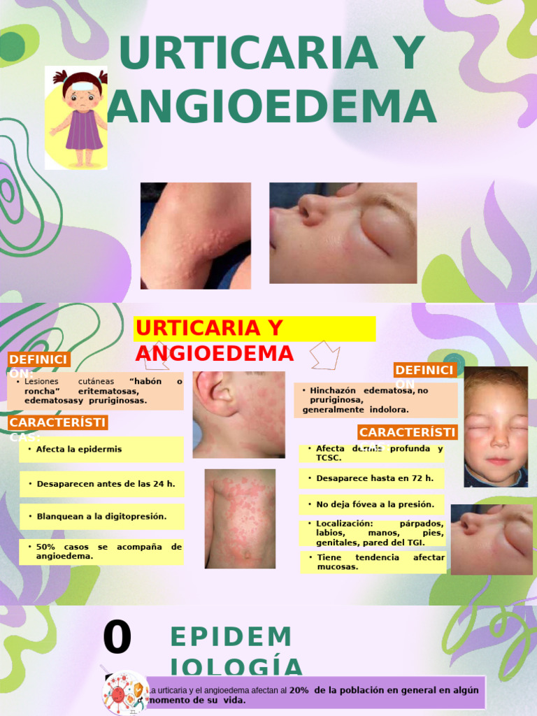 Urticaria y Angioedema: Causas y Tratamiento | PDF | Alergia ...
