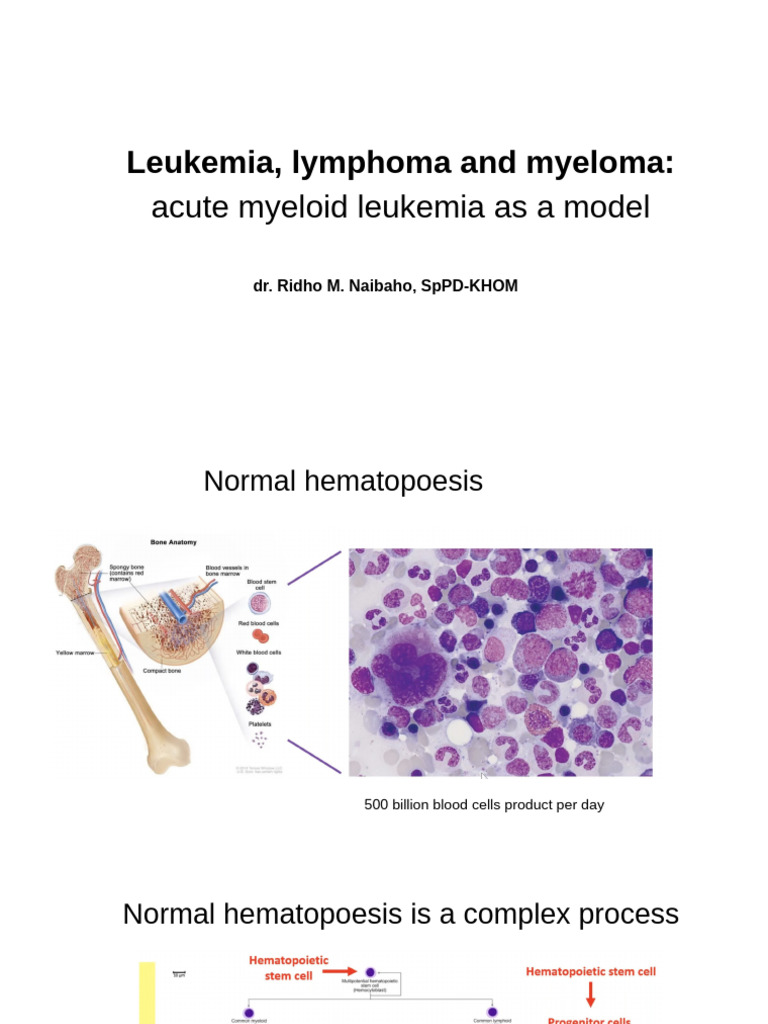 Leukemia, Lymphoma and Myeloma:: Acute Myeloid Leukemia As A Model | PDF