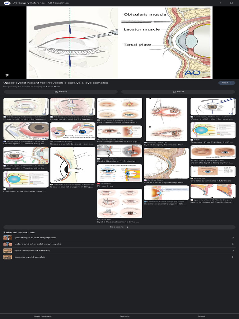 Httpswww.google.comsearchq=Weight+Eyelid+Surgery&Sca Esv=593546230&Rlz ...
