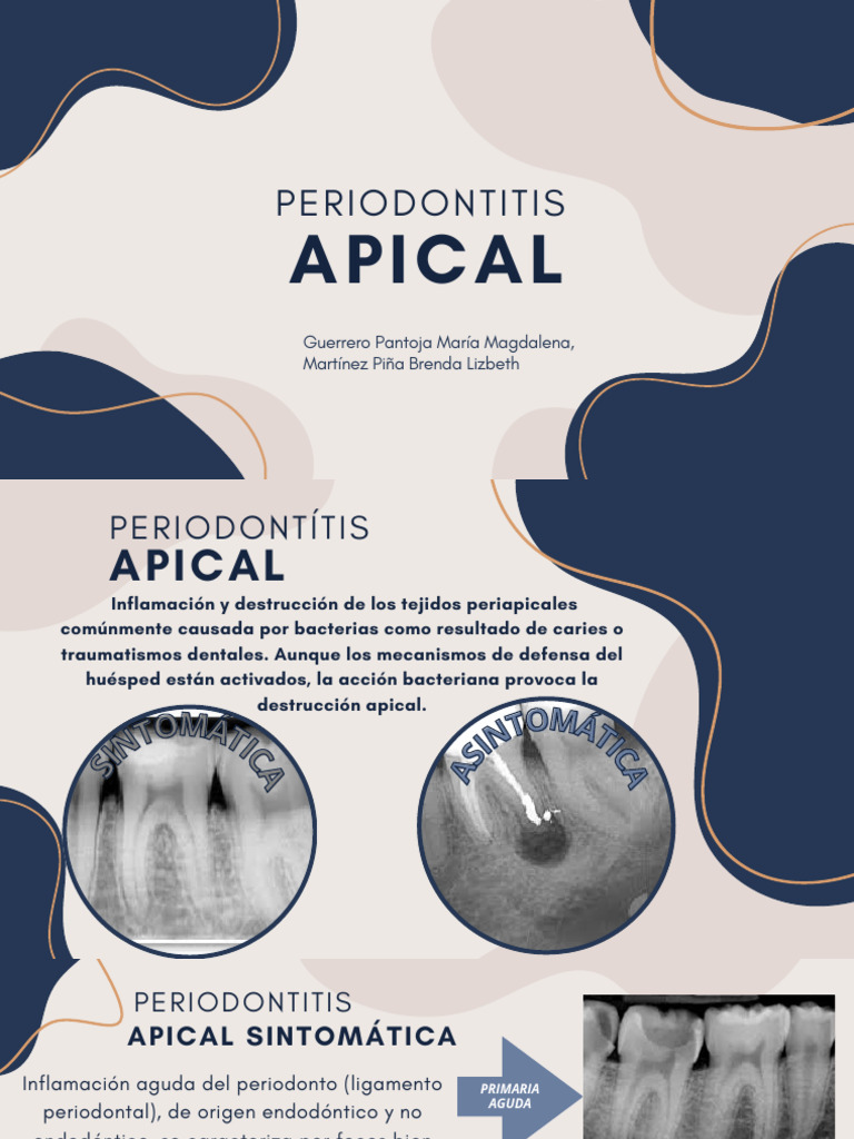 Periodontitis Apical: Clasificación y Diagnóstico | PDF | Inflamación ...