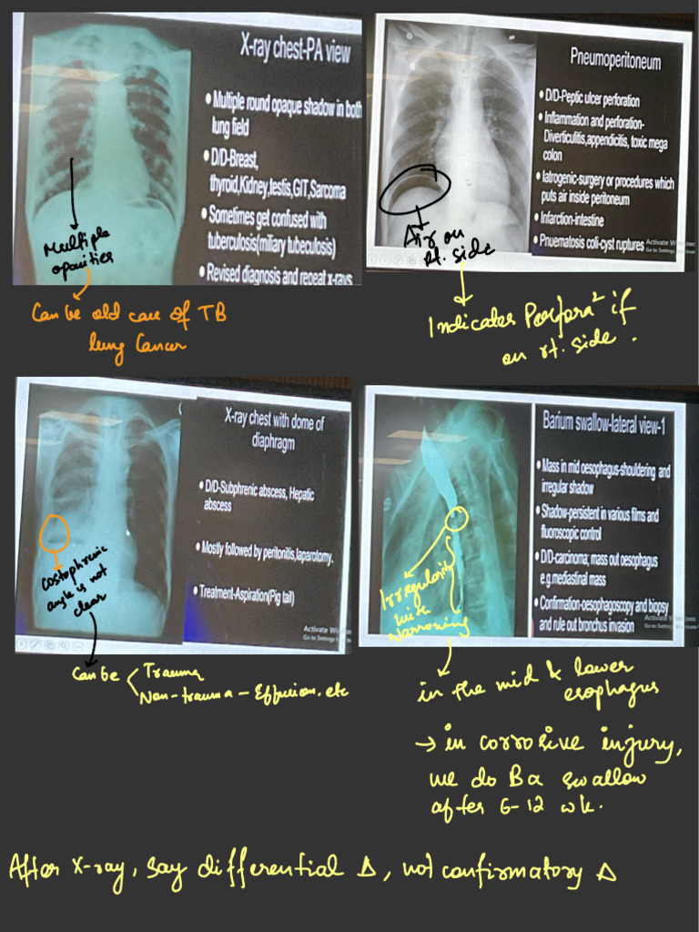 Surgery X Rays | PDF