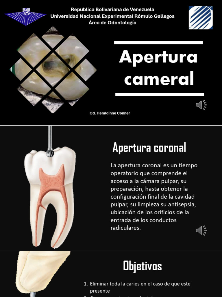 Apertura Cameral en Dientes Temporales | PDF | Anatomía de los primates ...
