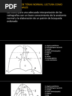 Grados de Cardiomegalia según ICT | PDF