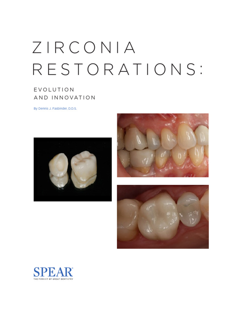Zirconia Arches: Evolution and Innovation | PDF | Zirconium Dioxide ...
